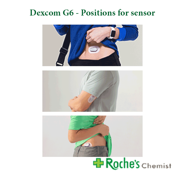 Dexcom G7 Continuous Blood Glucose Monitoring System - 10 day Supply ...